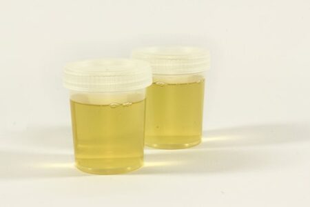 How Clean Is Urine? A Comprehensive Guide - GetMe Treated