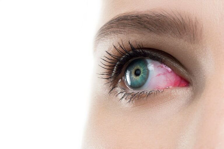 How To Remove Something Stuck in Your Eye? - GetMe Treated